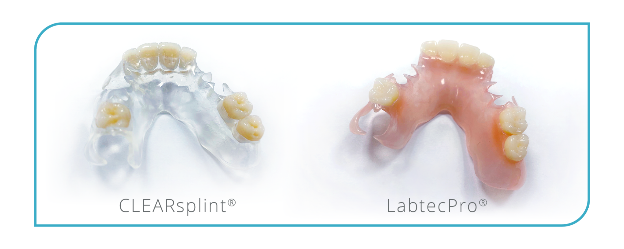 Temporäre Teilprothese - InteraDent Zahntechnik